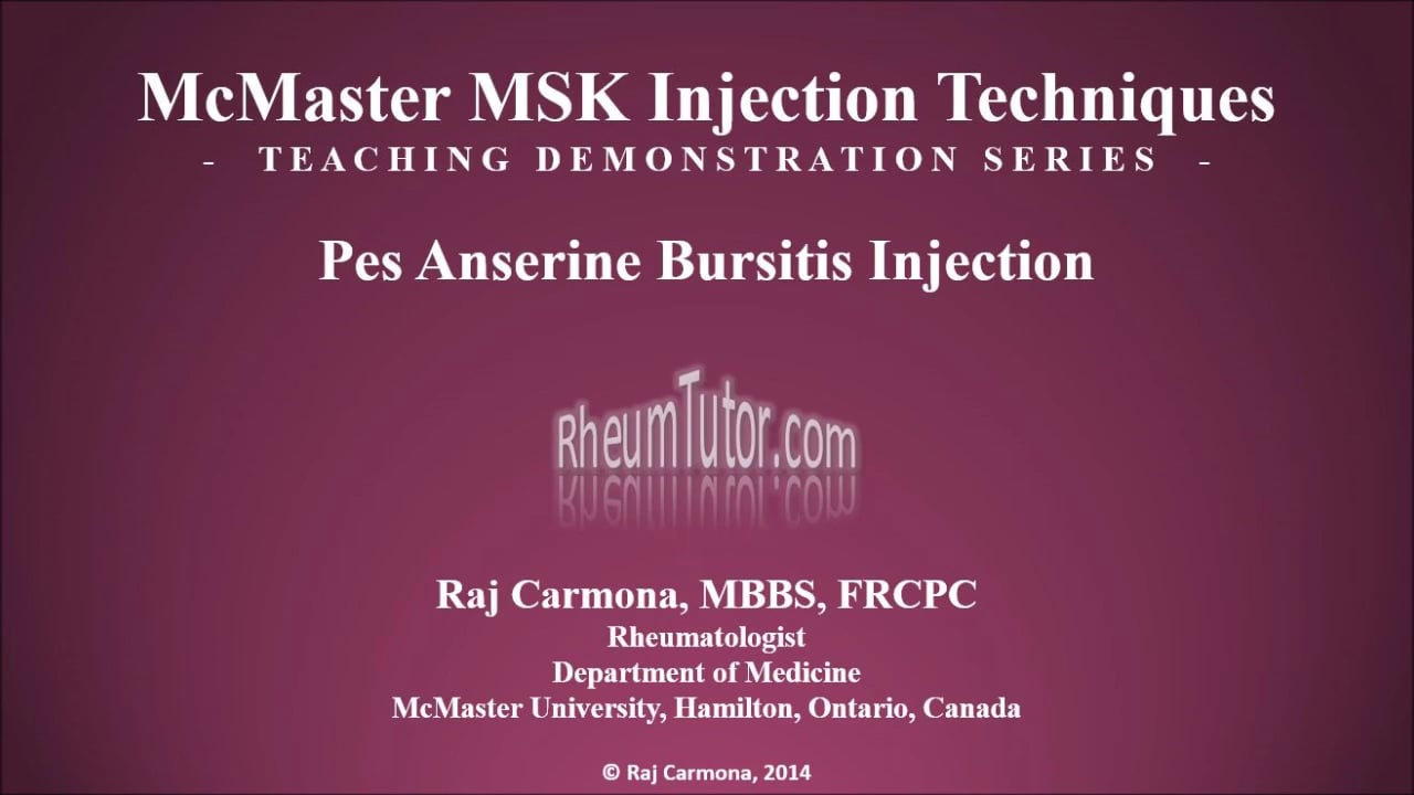 Pes Anserine Bursitis Injection on Vimeo