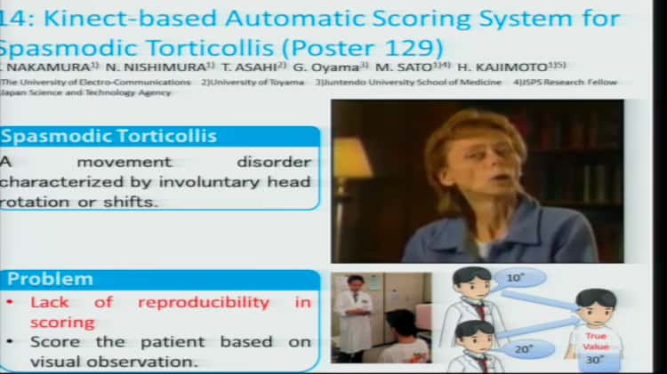 Spasmodic Torticollis