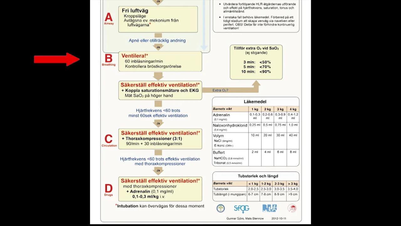 Kvinnokliniken - Umeå - Neonatal HLR logaritm on Vimeo