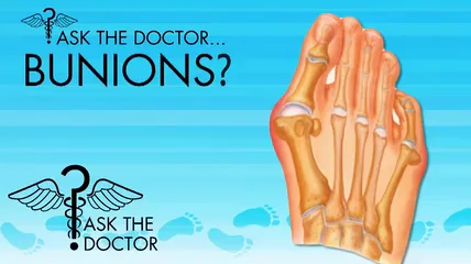 What Are The Treatments For Bunions? Podiatrist in Rome, GA - Brian ...