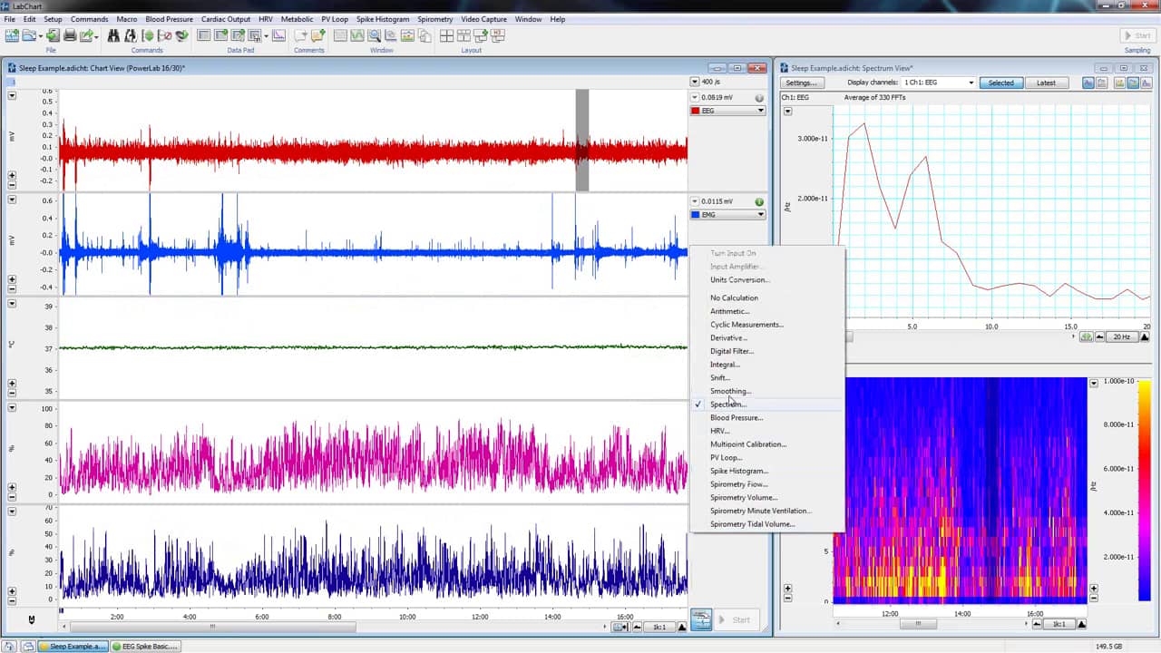 LabChart Mastery: Techniques for Analyzing Rodent EEG for Sleep and ...