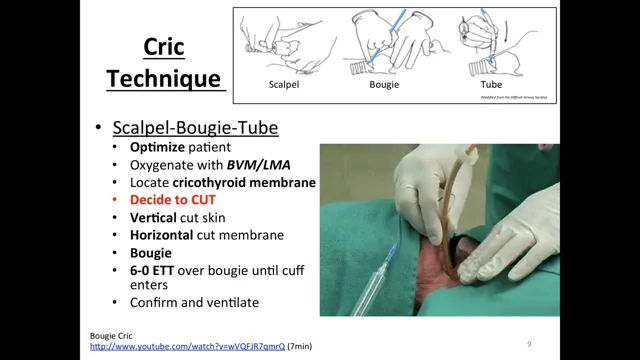 Cricothyroid Membrane Incision