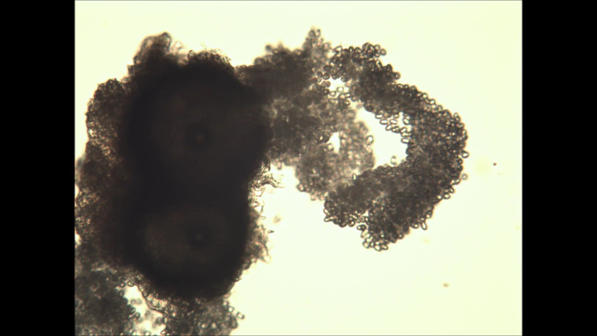 Pycnidia of Phyllosticta citricarpa oozing conidia on Vimeo
