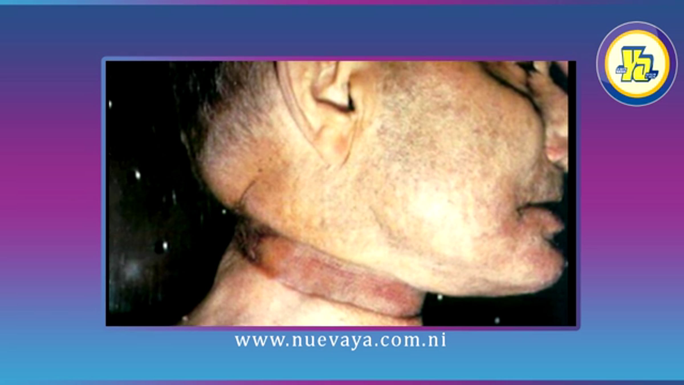 Revelan supuesta foto del cadáver de Robin Williams