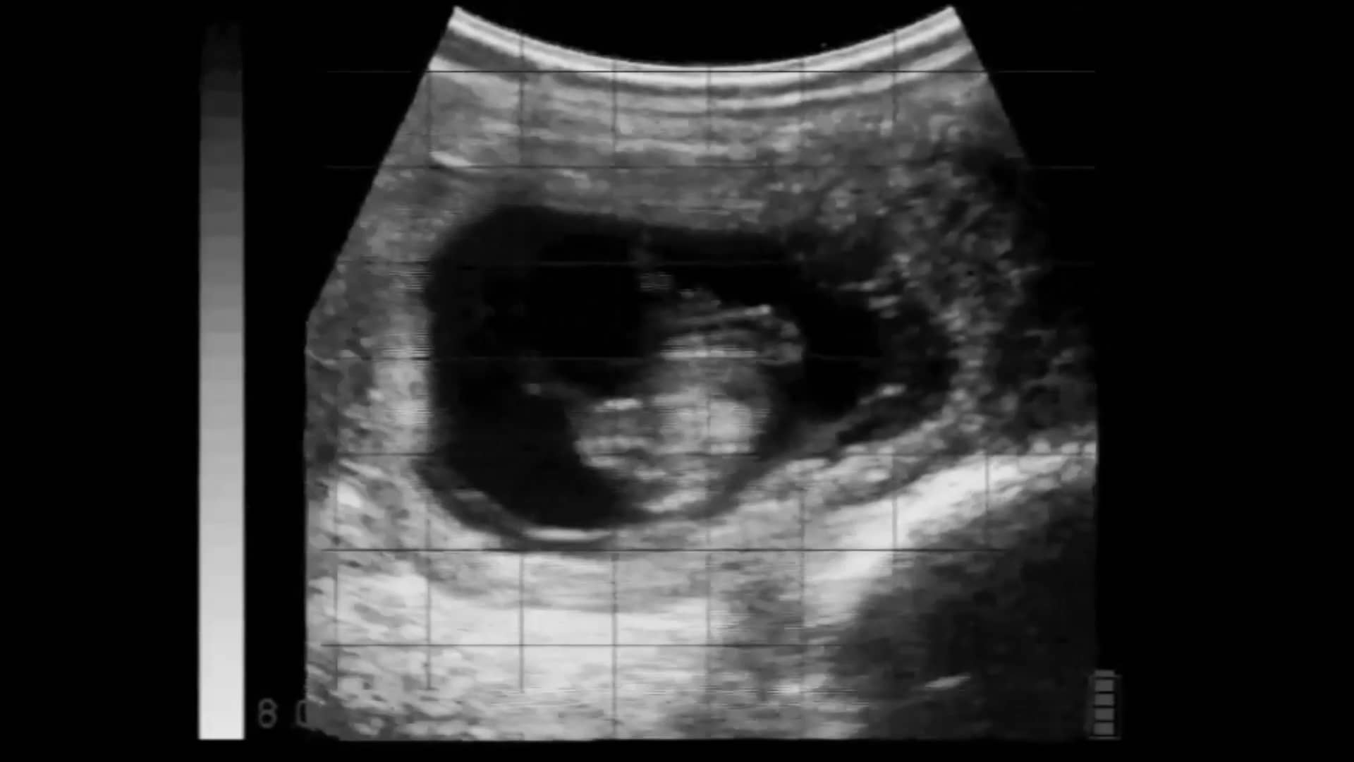 Fetus normal bovine 65 day bull calf BCF Easi-Scan Curve on Vimeo