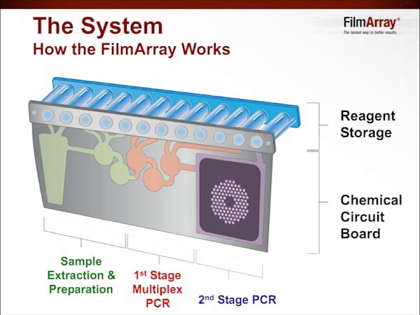 CAP TODAY Webinar - Focus on FilmArray on Vimeo