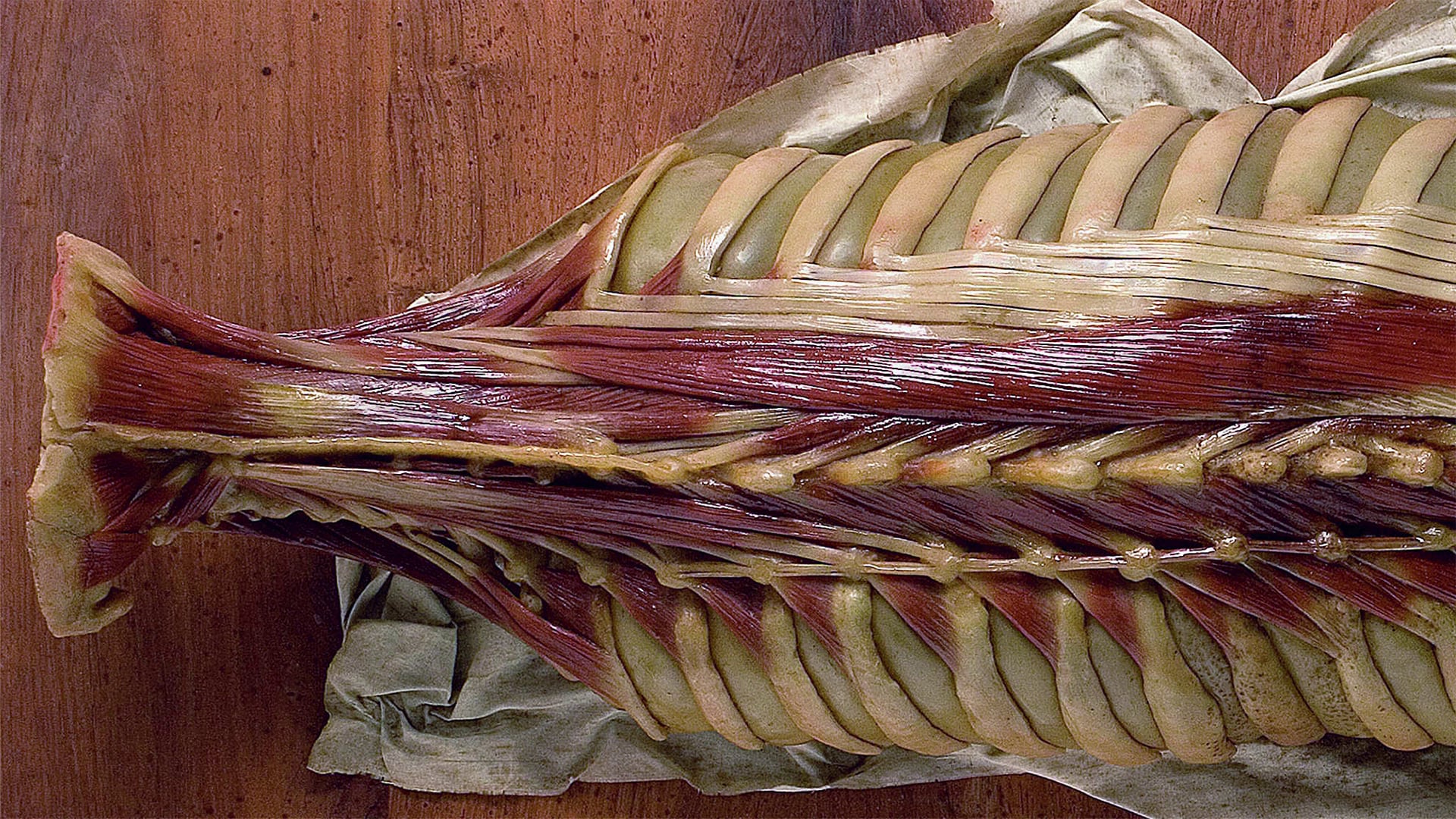 Table II from the Wax Anatomical Models by Clemente Susini on Vimeo