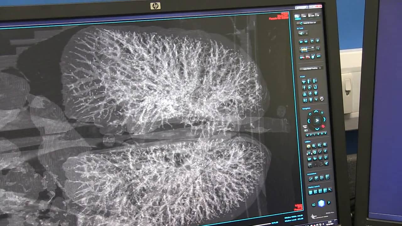 Digital autopsy flagship unit on Vimeo