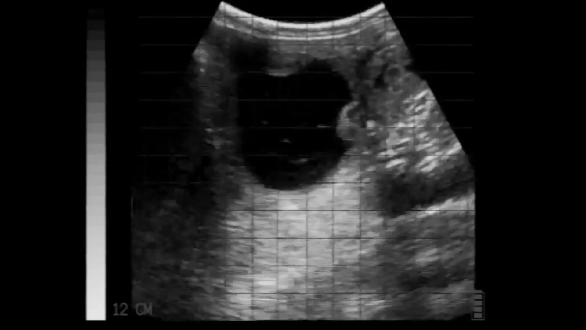 Fetus normal bovine 65 day bull calf BCF Easi-Scan on Vimeo