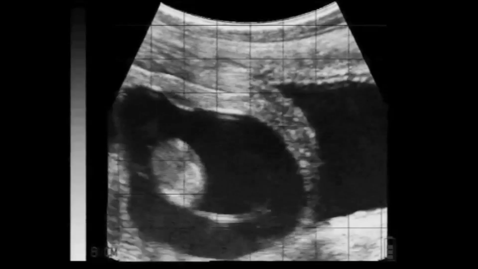 Fetus normal bovine late pregnancy CL BCF Easi-Scan on Vimeo