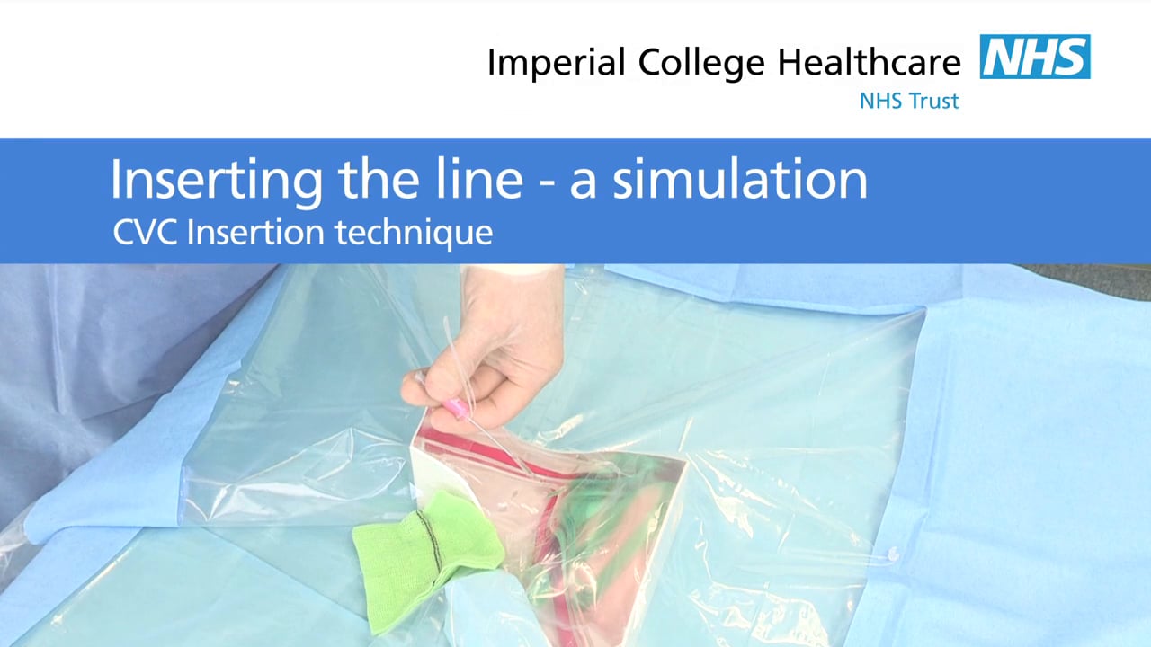 CVC insertion technique - The CVC insertion procedure on Vimeo