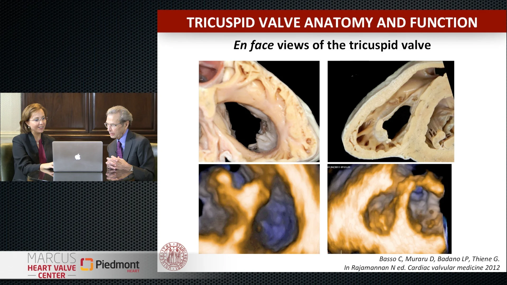 Marcus Heart Valve Center - Echocardiographic Approach to the Tricuspid ...