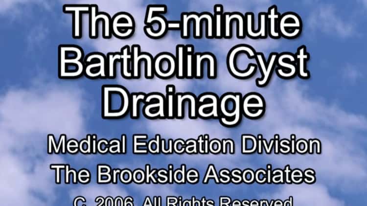 Bartholins Cyst Popping