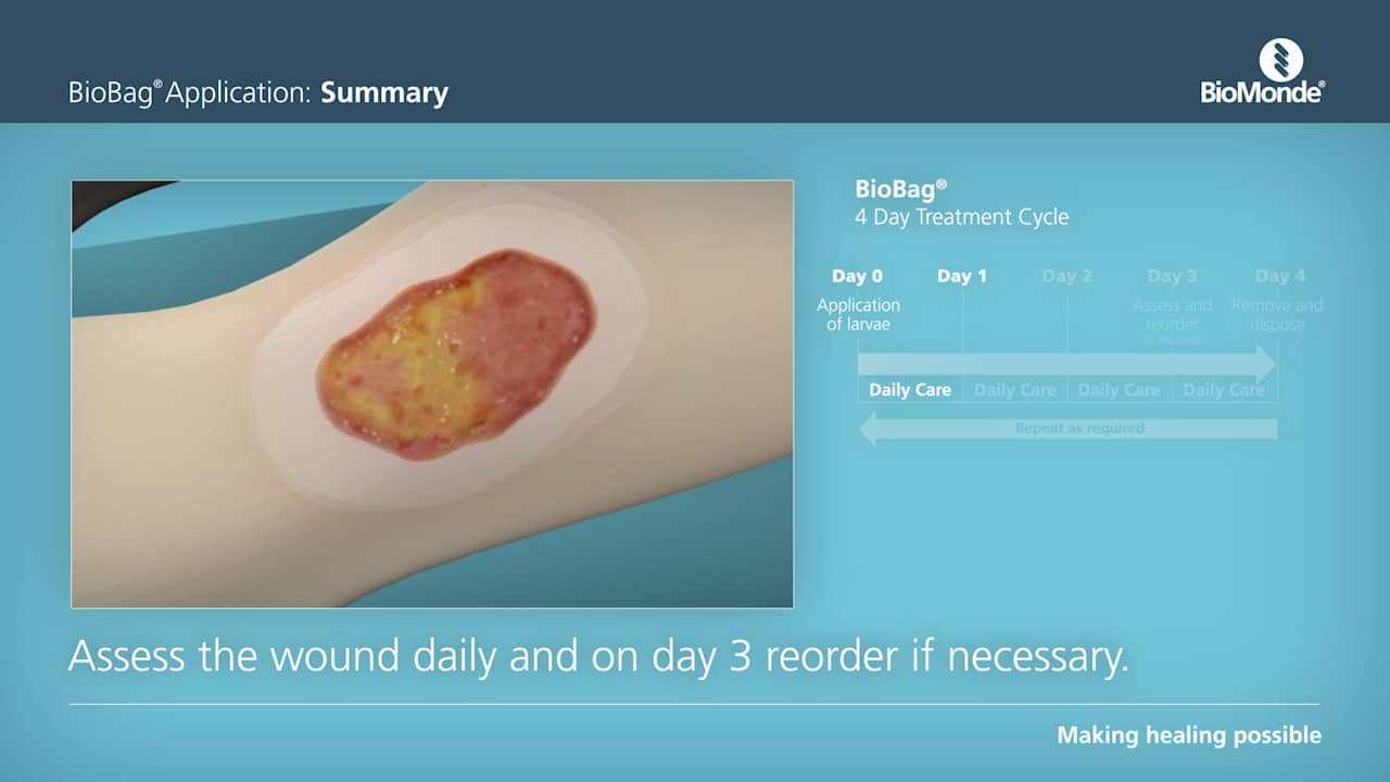 BioMonde BioBag Application Summary on Vimeo
