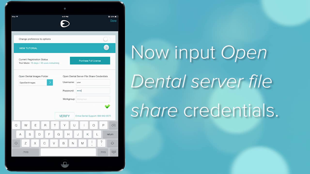 Getting Started with Enlive Paperless Dentist on Vimeo