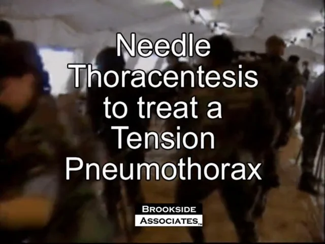 Thoracentesis Procedure Steps