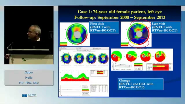 EGS2014 Gabor Hollo Structure-function correlation with Octopus Cases ...