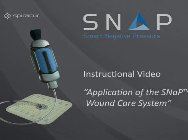 SNaP Wound Care system Application to Lower Extremity Wound - Training ...