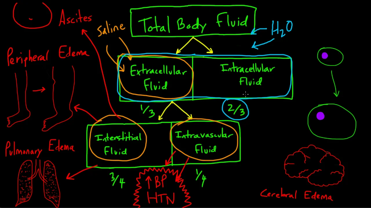 Session 1: Body Fluid Compartments in Fluids and Electrolytes Duke ...