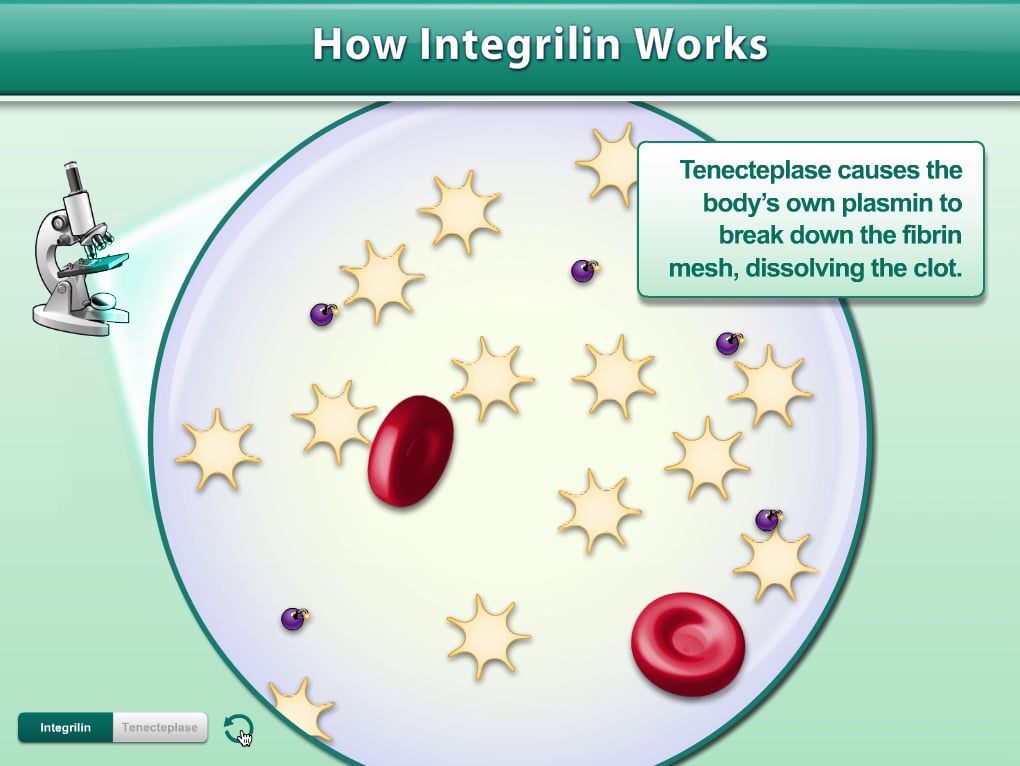 Integrilin Tutorial on Vimeo