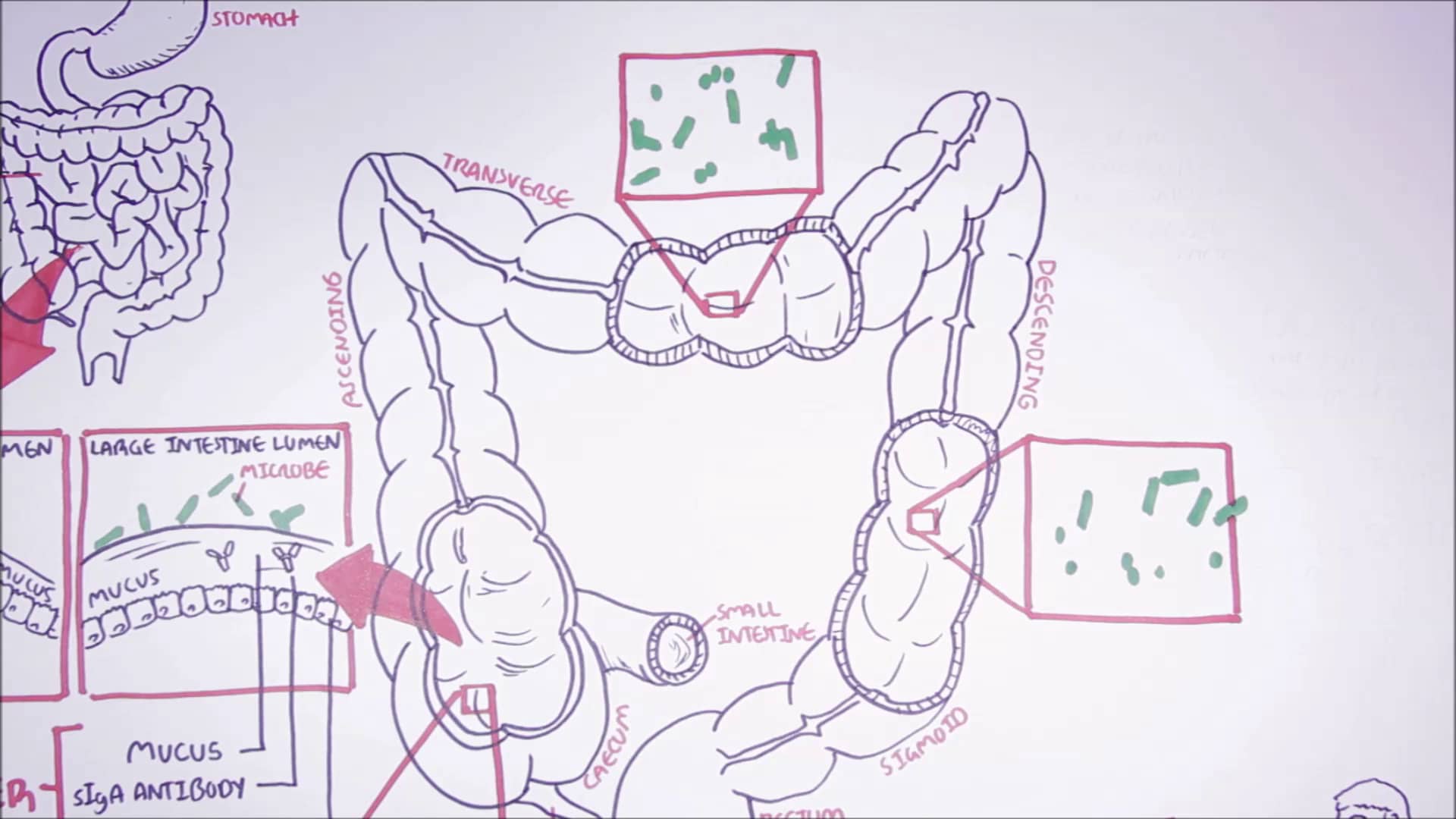 The Hungry Microbiome Project: Gut Microbiome on Vimeo