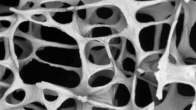 Videos - Bone Research Society