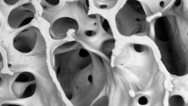 Videos - Bone Research Society