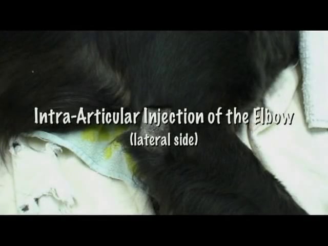 Surgical Procedures - Intra-Articular Injection of the Elbow (Lateral ...