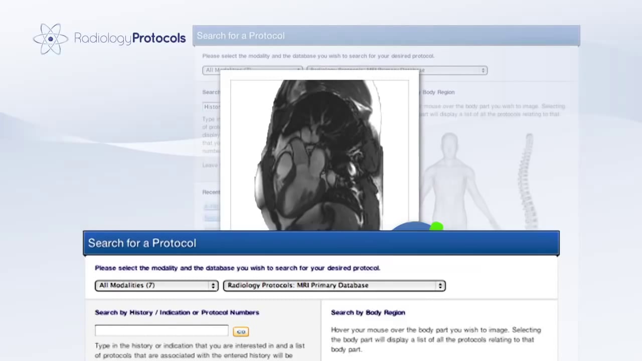 Radiology Protocols on Vimeo
