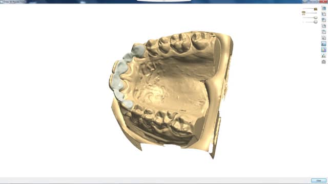 3shape Advanced: Maryland Bridge on Vimeo