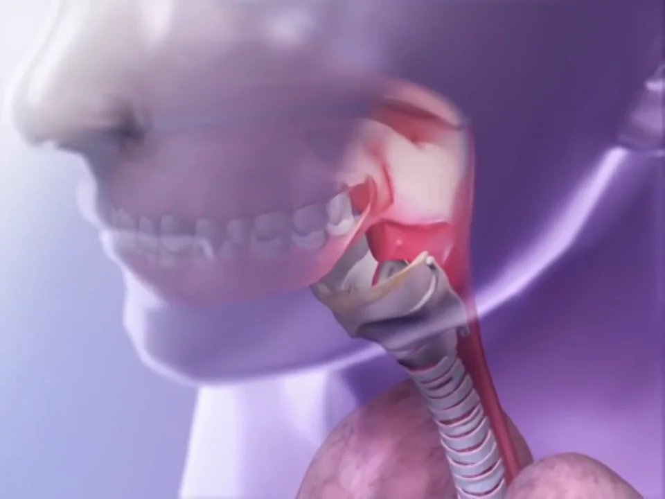 The Structure and Function of the Epiglottis