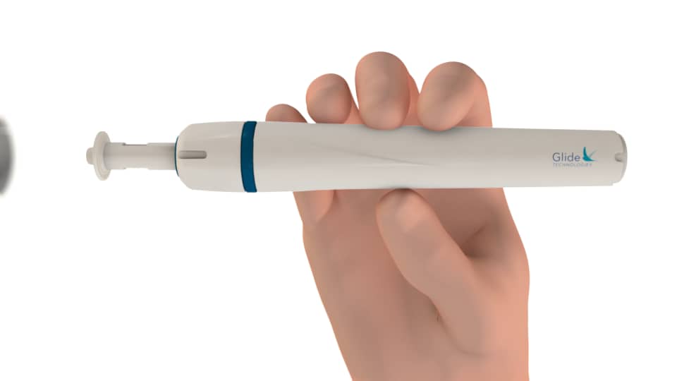 Glide Technologies SDI® on Vimeo