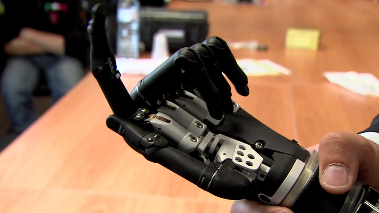 Changer de vie avec une main bionique on Vimeo