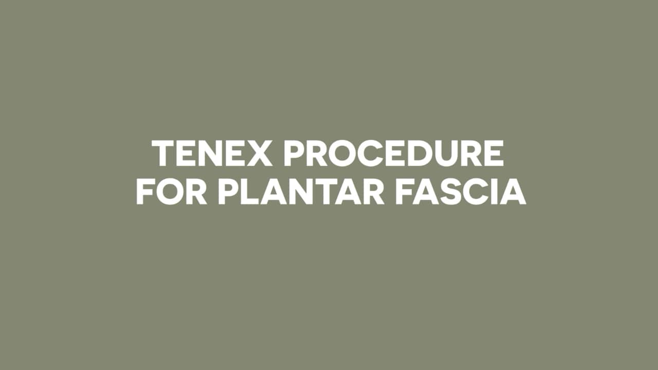 Tenex Procedure for Plantar Fascia Treatment by UCLA Affiliated Foot ...