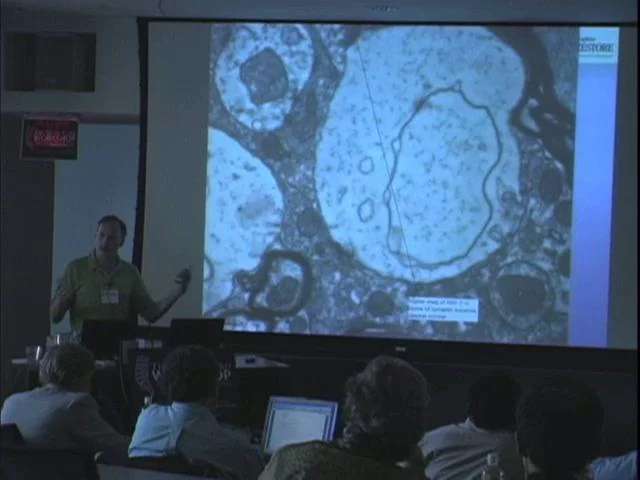 Douglas Kerr, MD, PhD - 2009 Spinal Cord Workshop on Vimeo