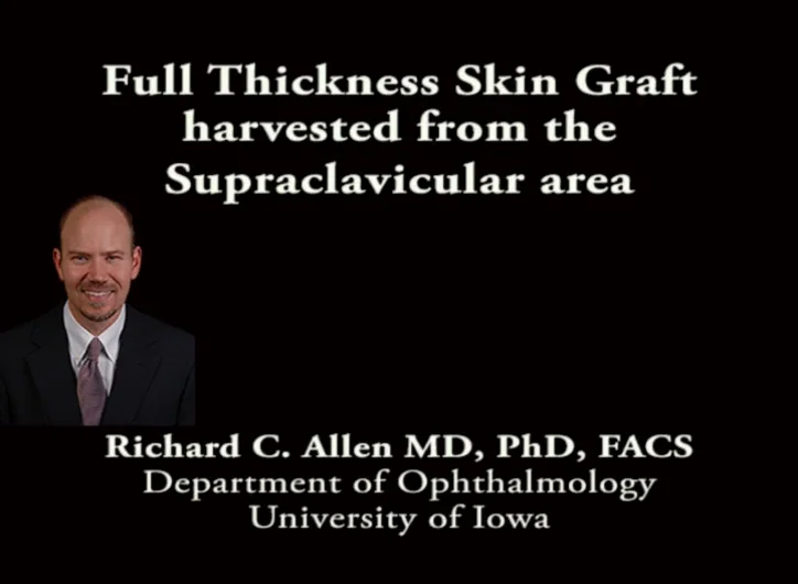 Full thickness skin graft from supraclavicular area