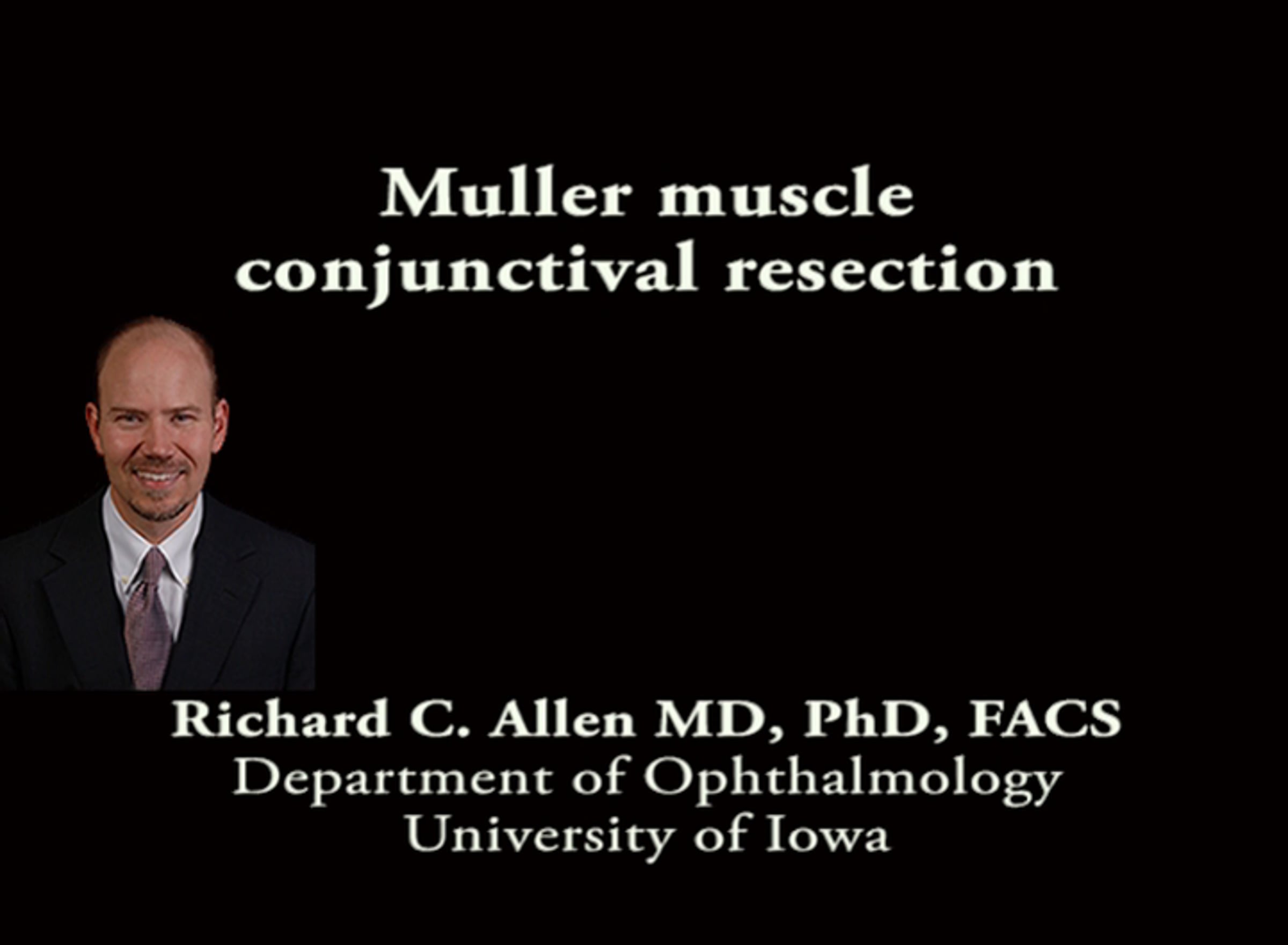 Muller muscle conjunctival resection