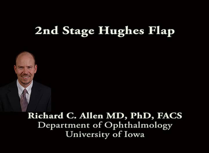 Second stage Hughes flap on Vimeo