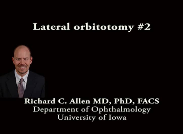 Lateral orbitotomy 2 on Vimeo