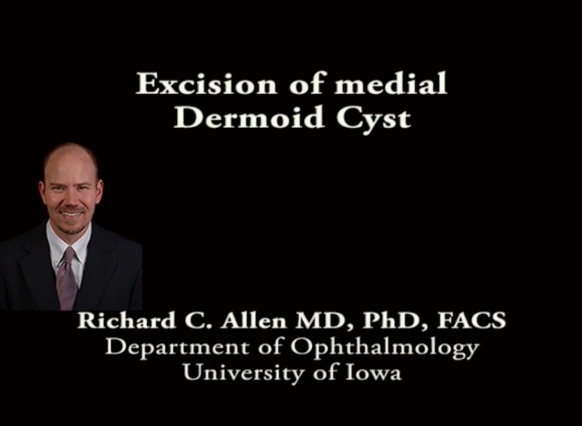 Excision of medial dermoid cyst