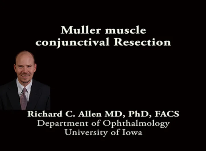 Muller muscle-conjunctival resection (2)