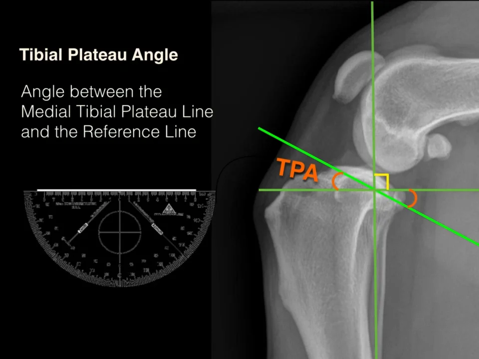 Measuring Tibial Plateau Angle in Dogs on Vimeo