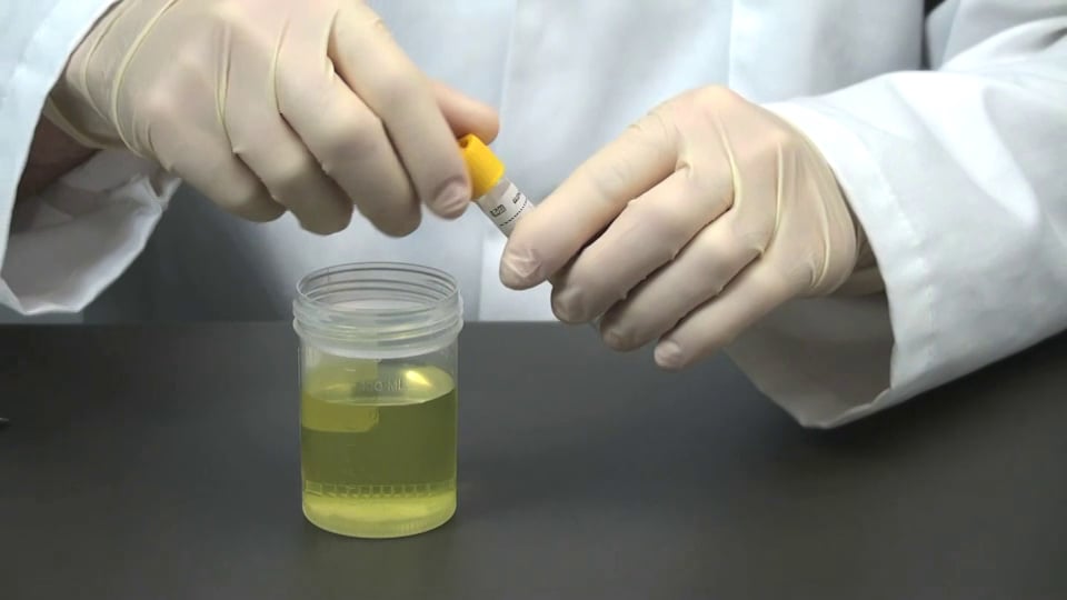 How to Use COPAN's UriSponge for Urine Collection on Vimeo