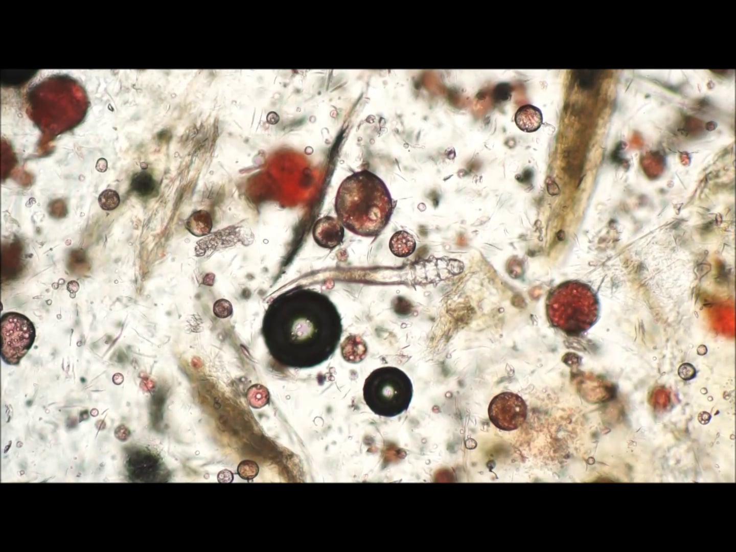Demodex injai on Vimeo