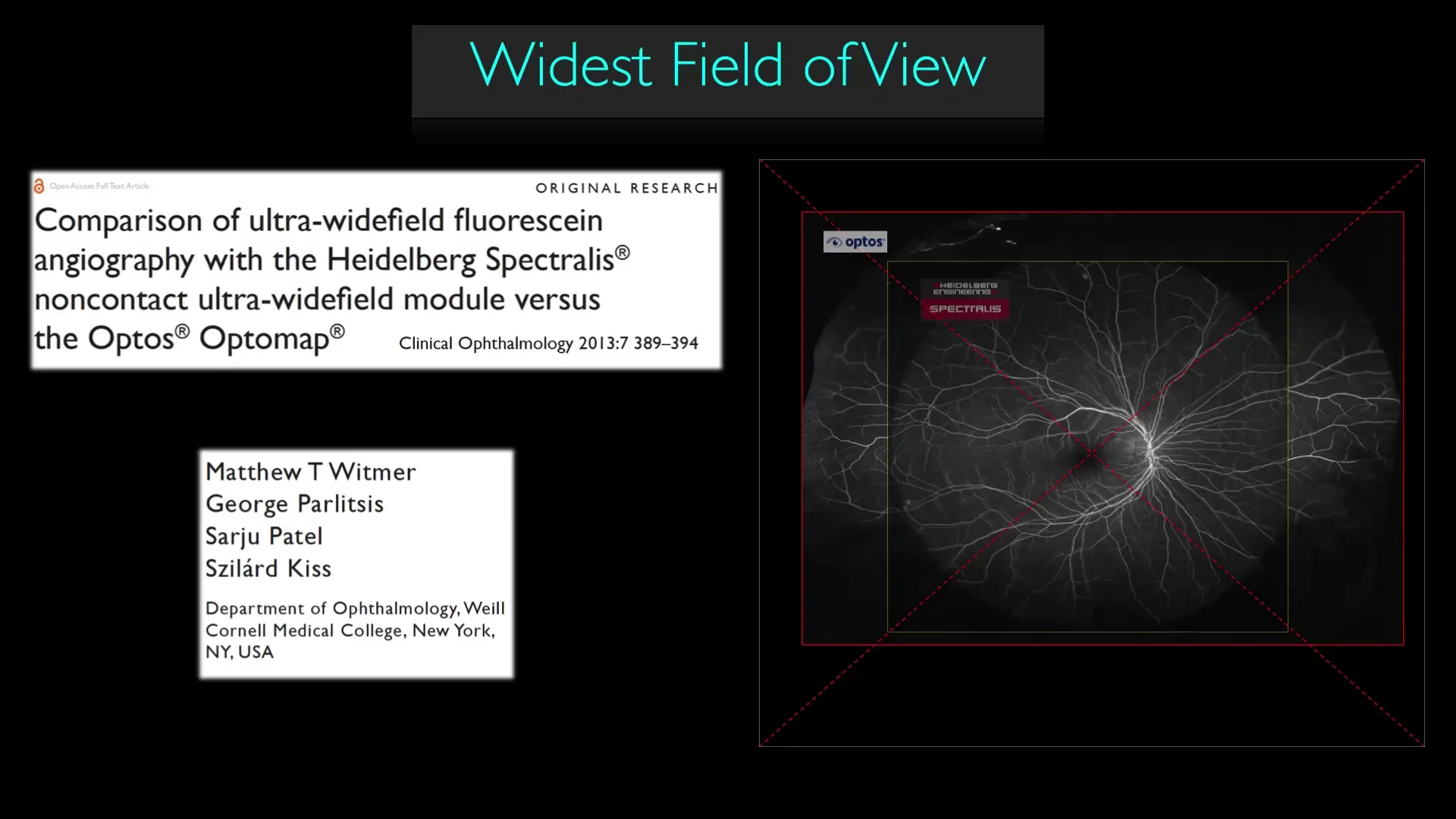 Cole Eye 5/20 - Cole Institute Retina Case Forum Webinar CME Series 1 ...