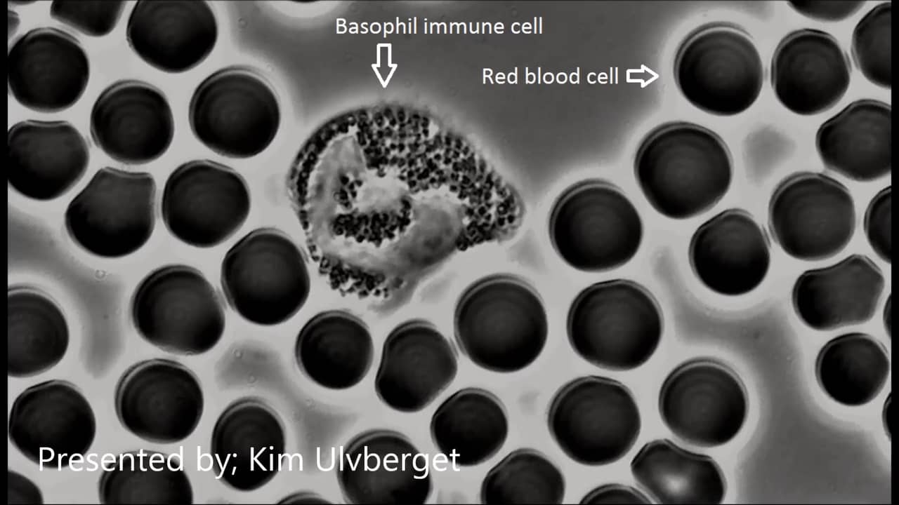 basophil immune cell under a microscope on Vimeo