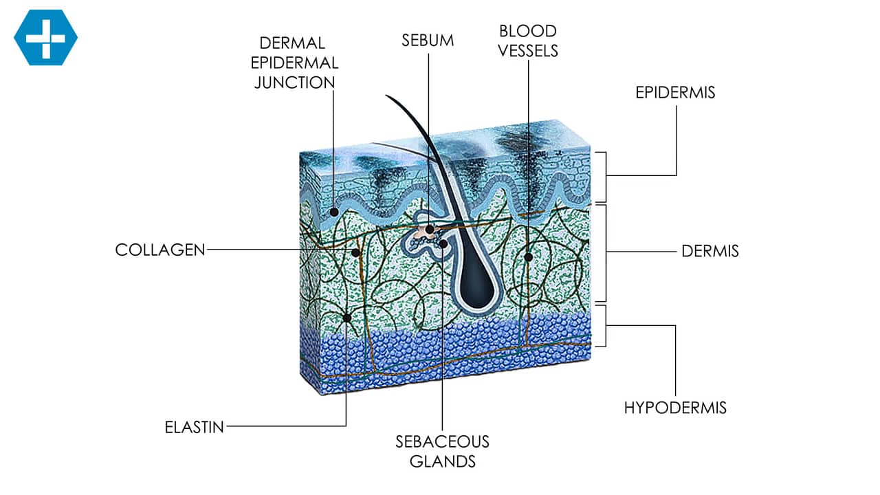 Skin Conditions - Skin Pigmentation on Vimeo
