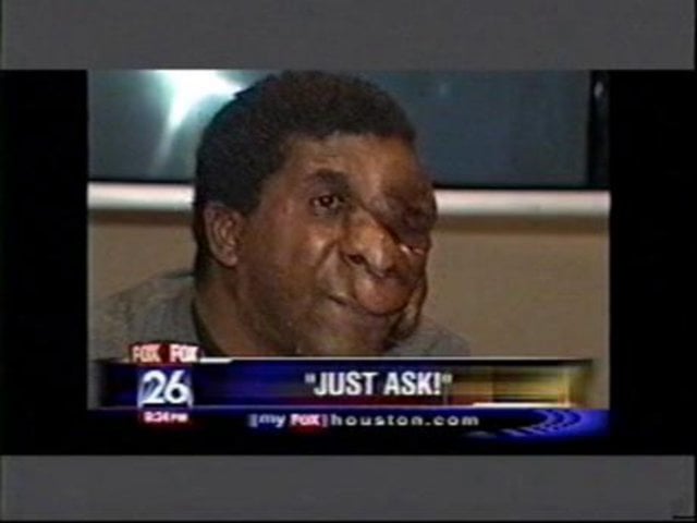 Neurofibromatosis Fundraising and Awareness Campaign on Vimeo