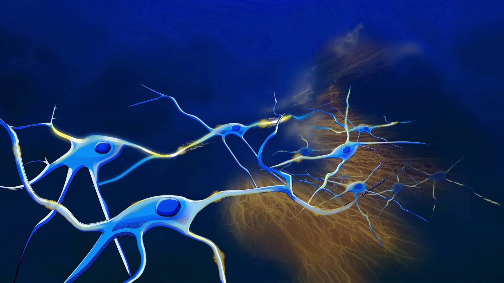 Epilepsy and Seizure Animation on Vimeo