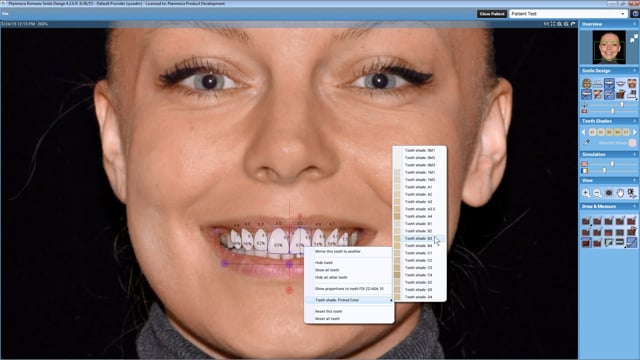 Planmeca Romexis Smile Design on Vimeo